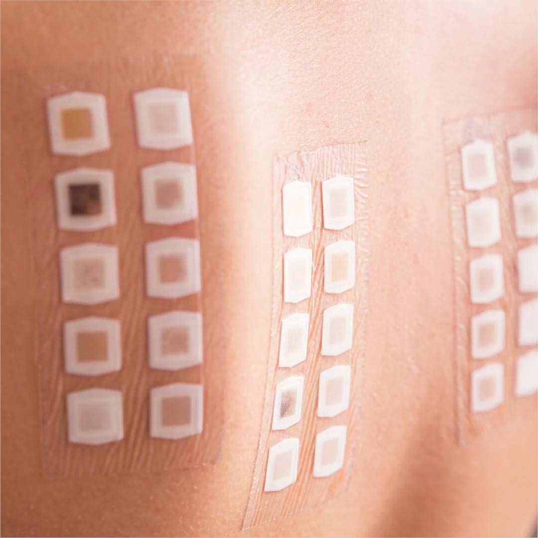 Dermatological tests (patch tests) - GBA POLSKA