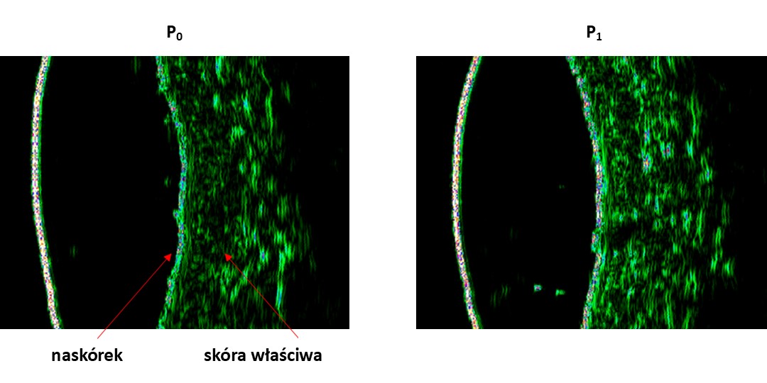 Badania aparaturowe - GBA POLSKA