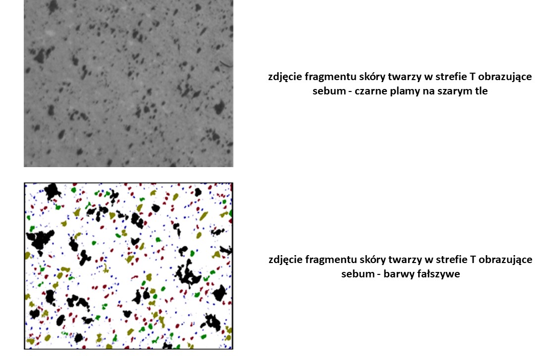 Badania aparaturowe - GBA POLSKA